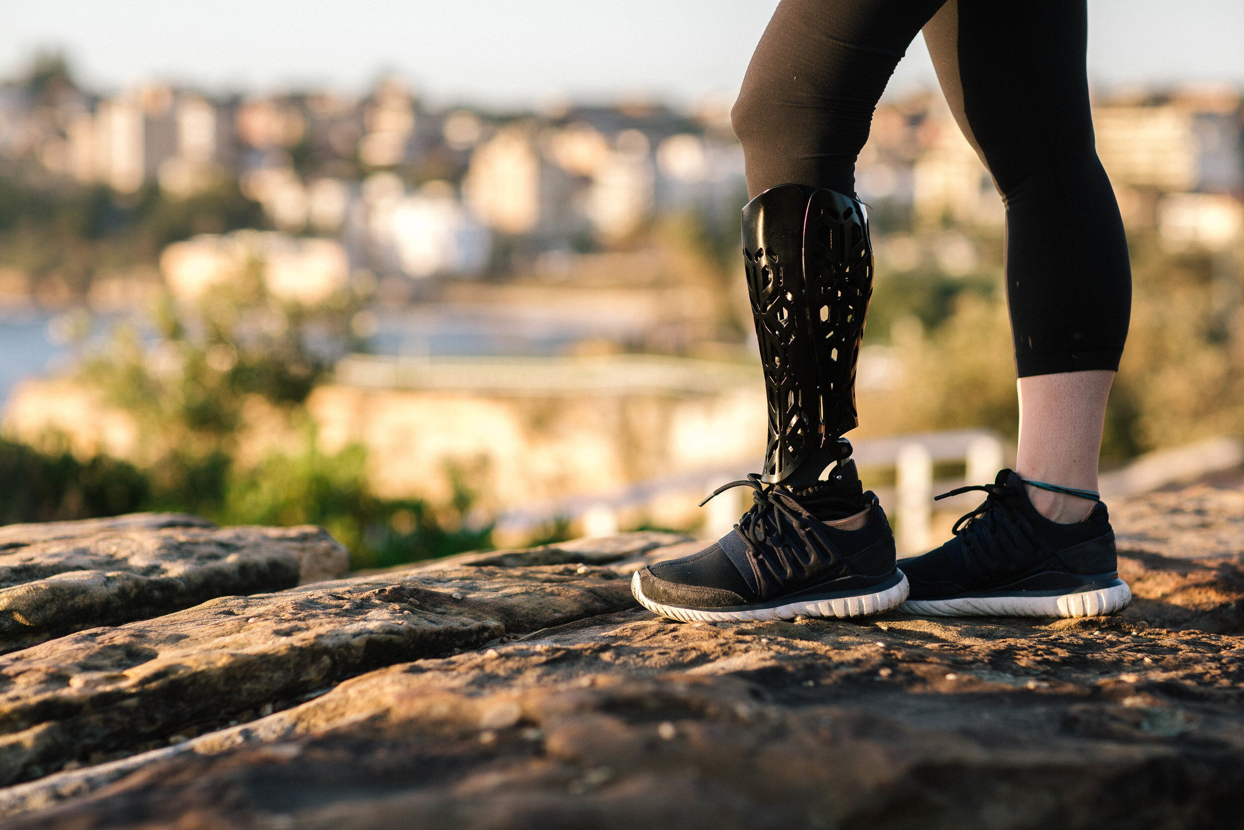 Prosthetic products by Hone Product Design at AOPA 2017 — Hone.pd